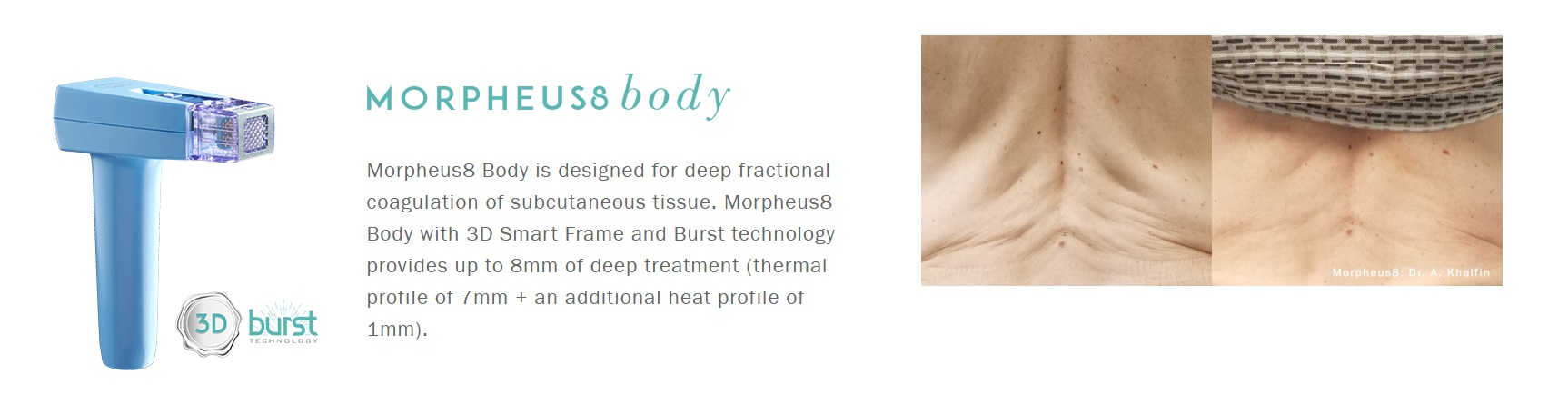 Revitalize Your Skin with InMode morpheus8 machine